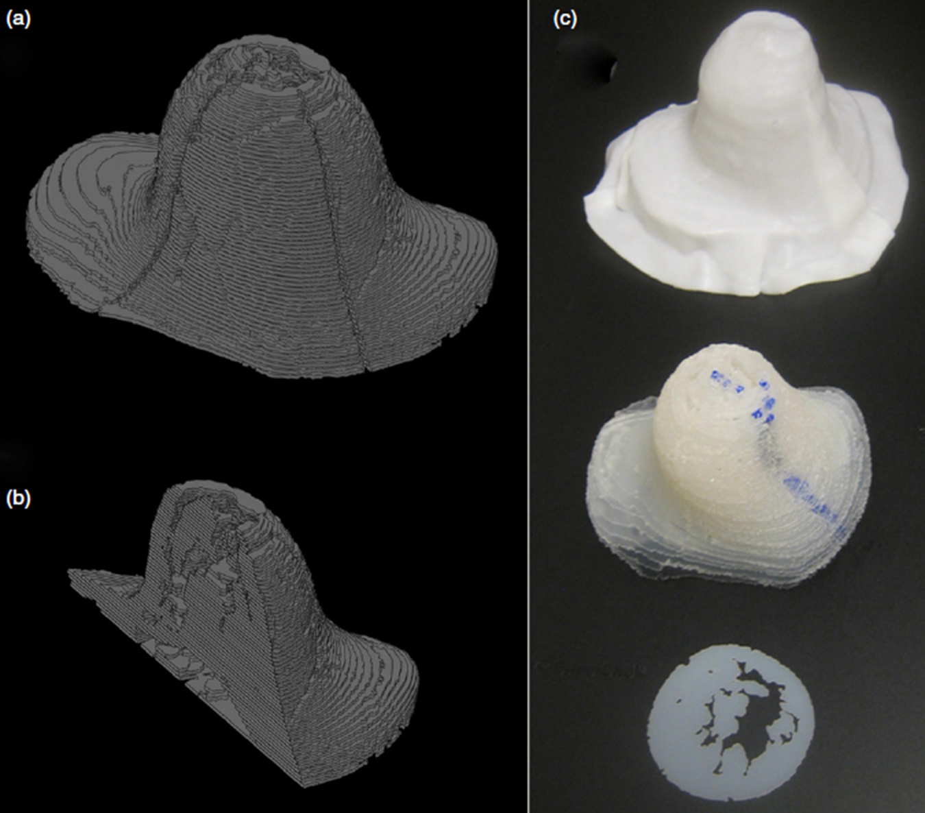Introduction to anthropomorphic phantoms - Book chapter - IOPscience