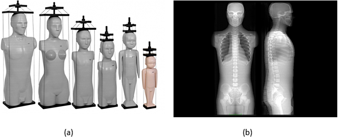 Introduction to anthropomorphic phantoms - Book chapter - IOPscience