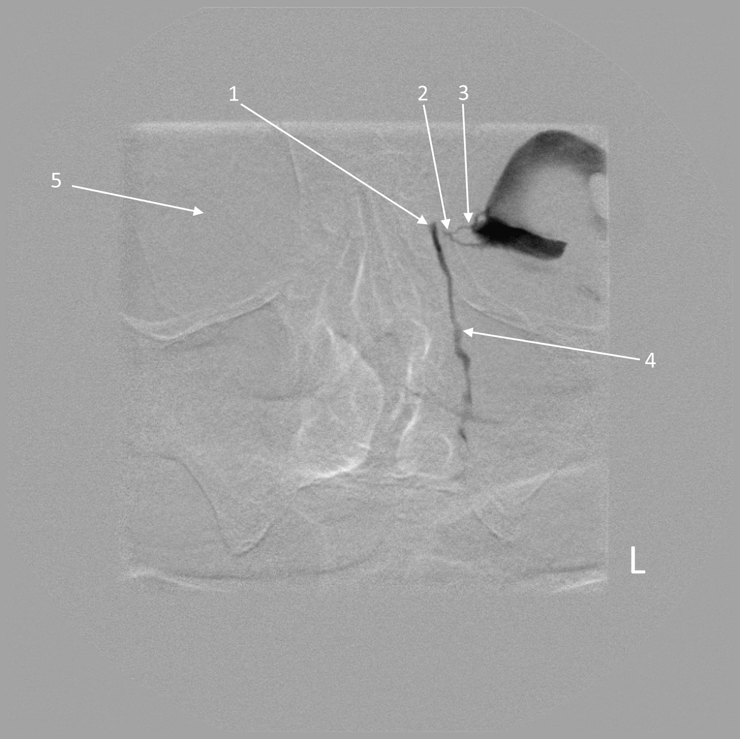 Head and neck - Book chapter - IOPscience