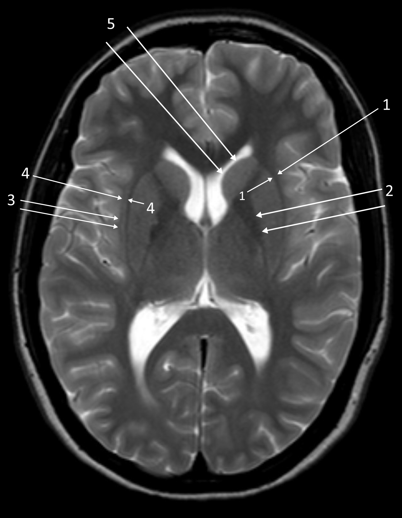 Head and neck - Book chapter - IOPscience