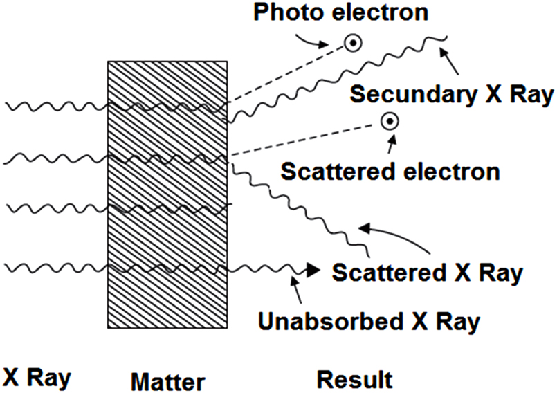 The basics of x-rays - Book chapter - IOPscience