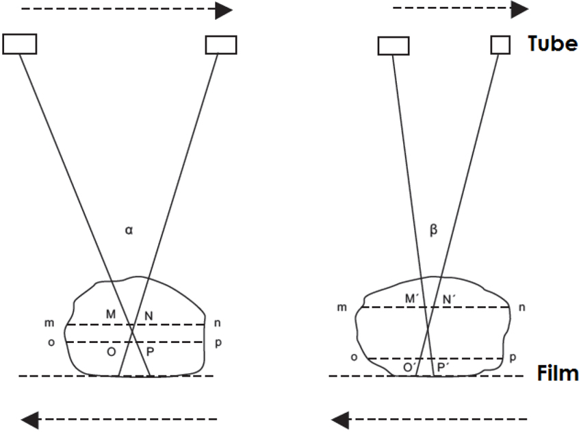 The components of x-ray devices - Book chapter - IOPscience