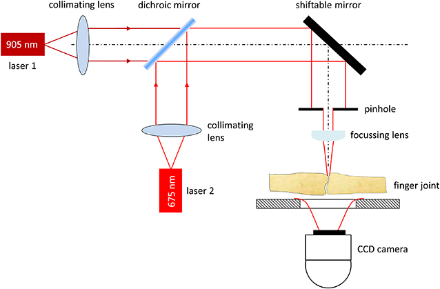 Lasers in medical diagnosis - Book chapter - IOPscience