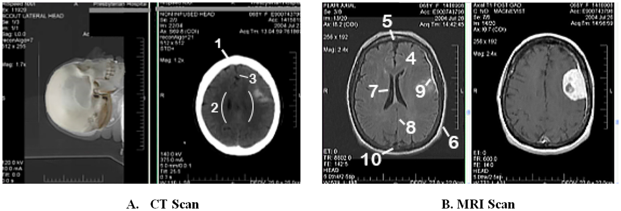 Five big ideas for MRI - Book chapter - IOPscience