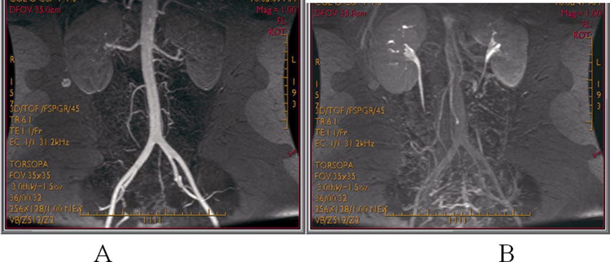 Basic building blocks for MRI - Book chapter - IOPscience