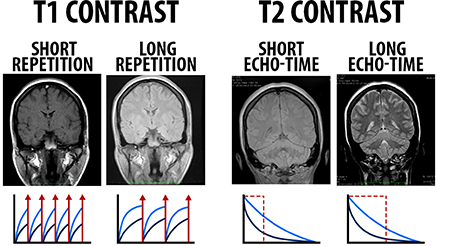 Basic building blocks for MRI - Book chapter - IOPscience