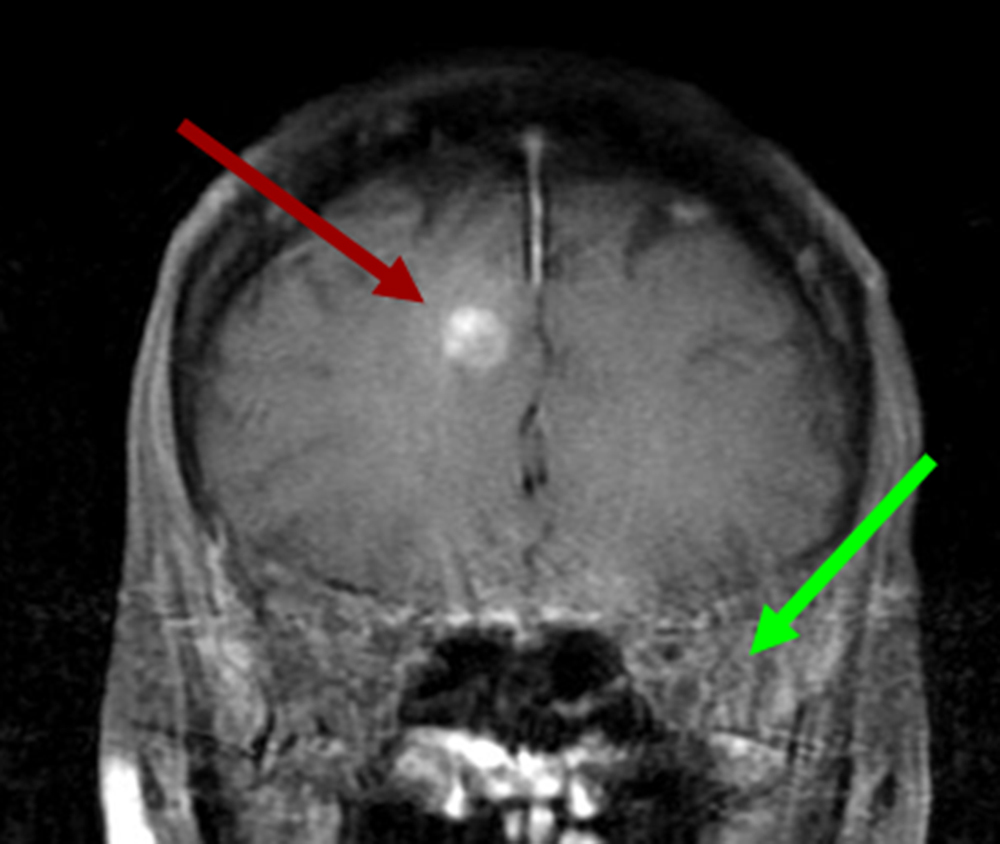 Basic building blocks for MRI - Book chapter - IOPscience