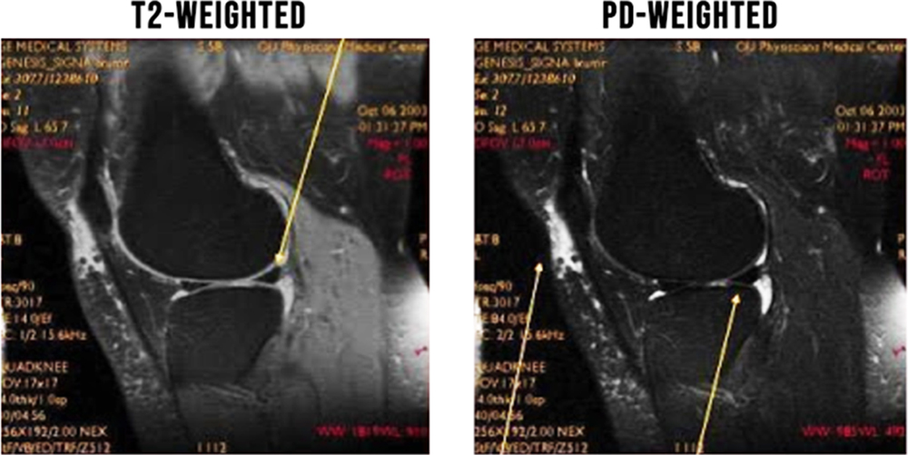 Basic building blocks for MRI - Book chapter - IOPscience