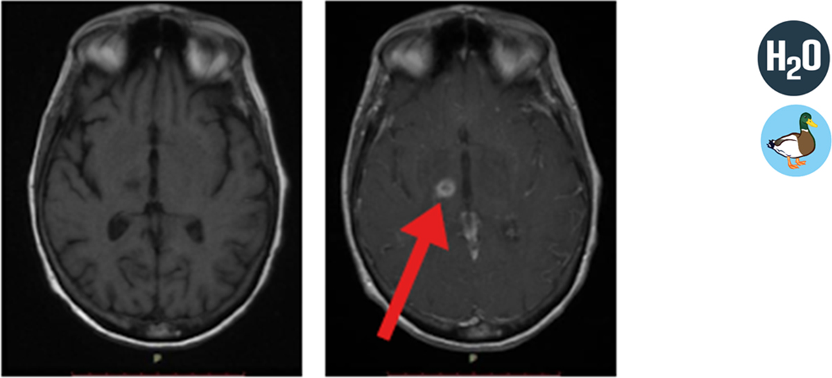Basic building blocks for MRI - Book chapter - IOPscience