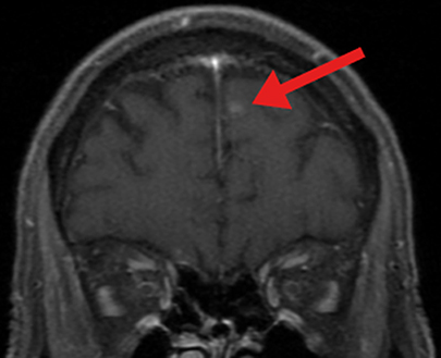 Basic building blocks for MRI - Book chapter - IOPscience