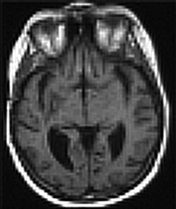 Basic building blocks for MRI - Book chapter - IOPscience
