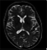 Basic building blocks for MRI - Book chapter - IOPscience