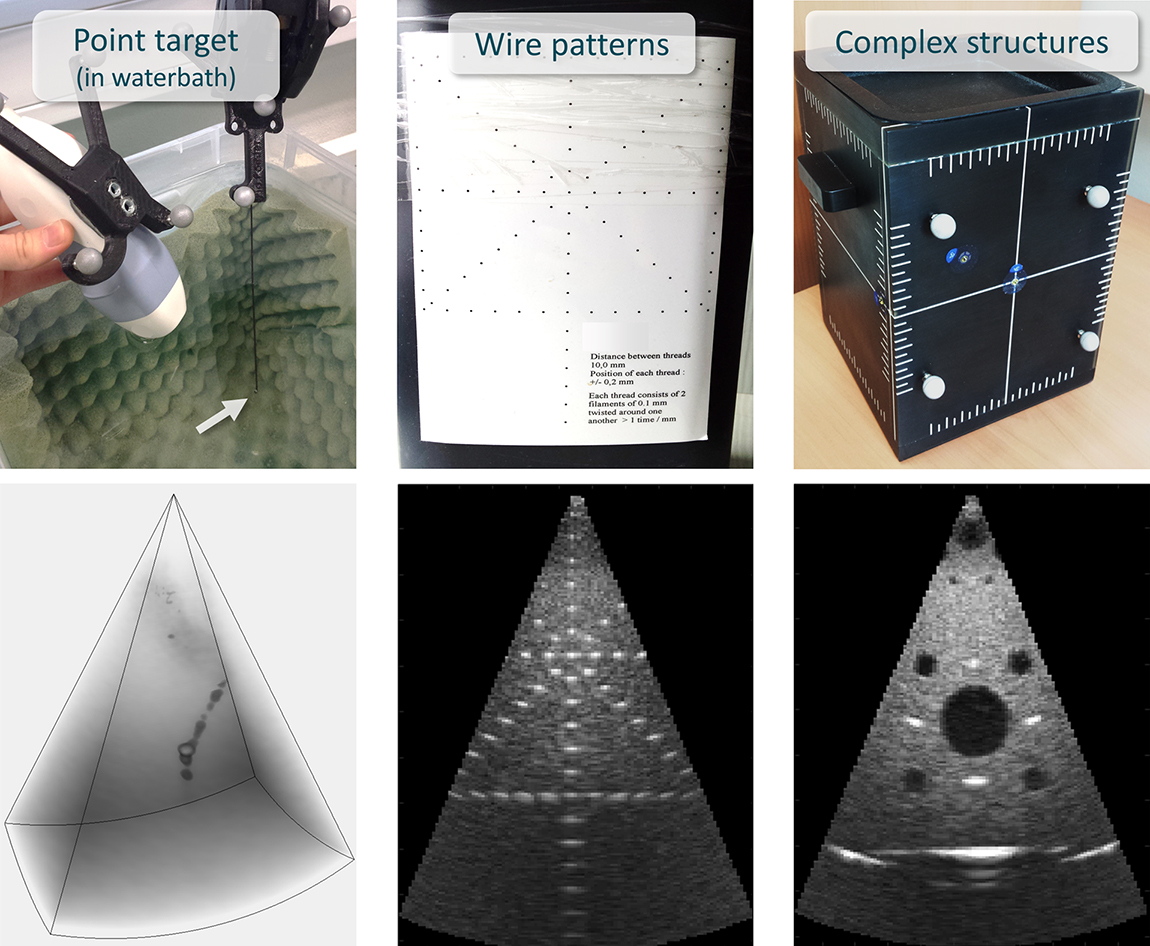 Registration of ultrasound with radiotherapy room coordinates - Book ...