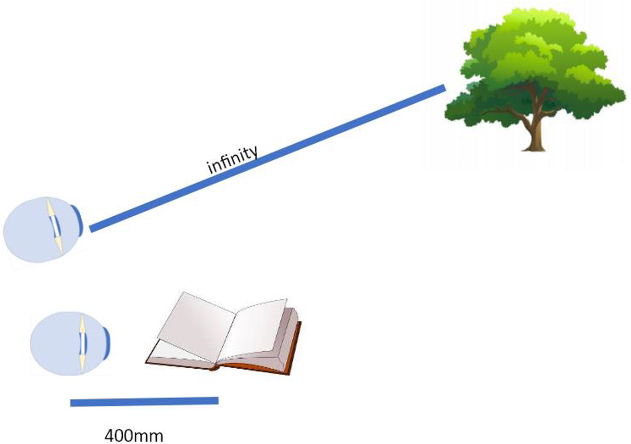 Mechanically adjustable lenses - Book chapter - IOPscience