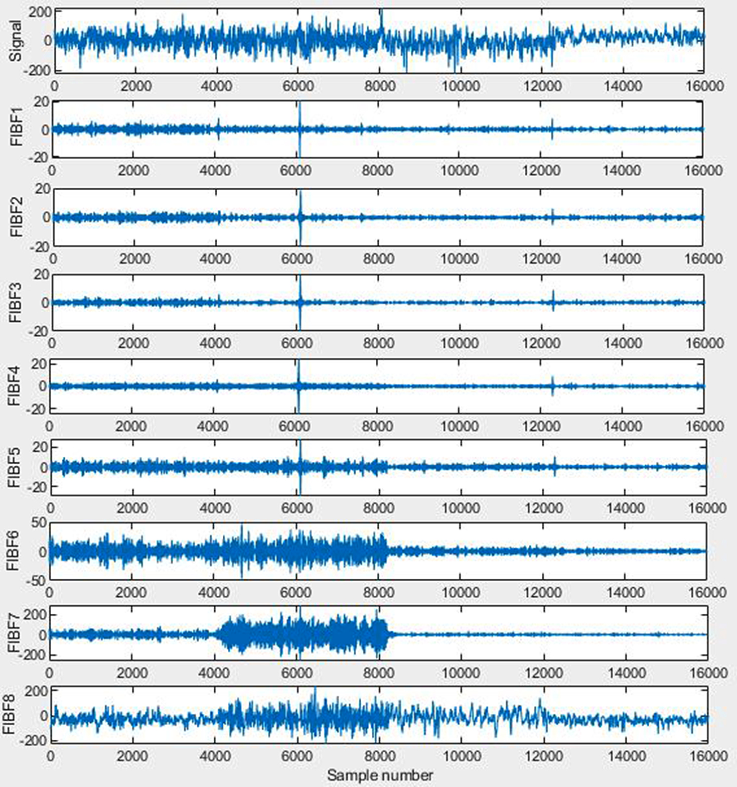 Noise removal and classification of EEG signals using the Fourier ...