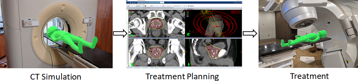 Artificial Intelligence in prostate cancer treatment with image-guided ...