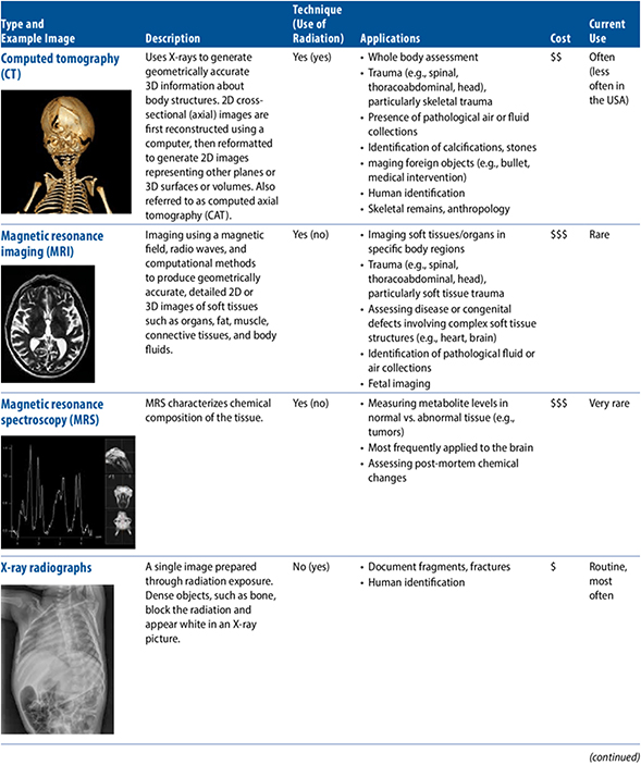 Introduction to imaging modalities - Book chapter - IOPscience