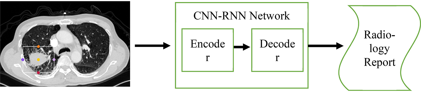 Machine learning in medicine—focus on radiology - Book chapter - IOPscience
