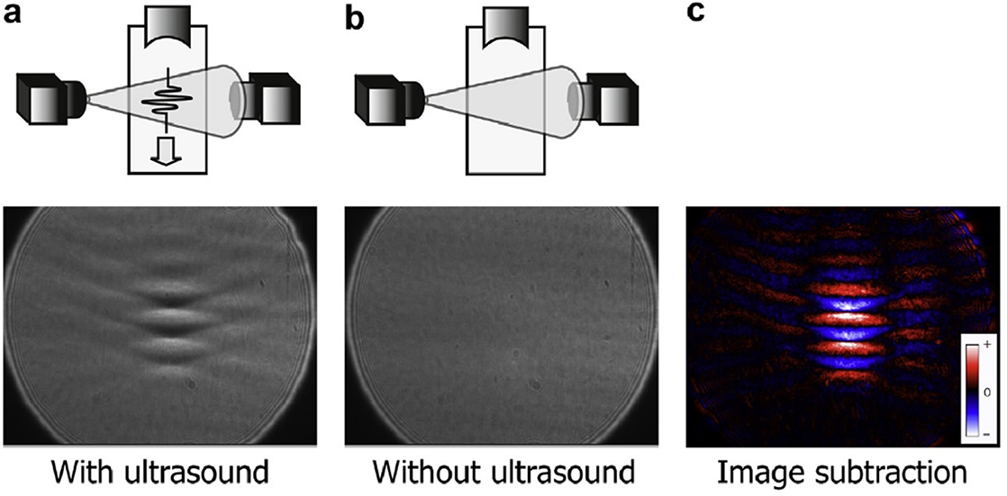 Ultrasound propagation - Book chapter - IOPscience