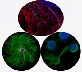 IOPscience - Biomaterials for Neural Repair and Regeneration