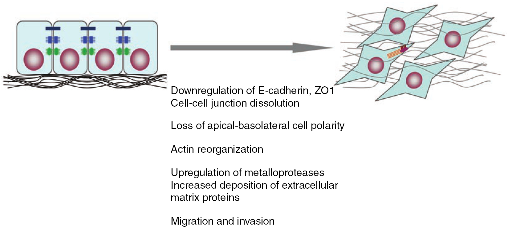 Jamming transitions in cancer - IOPscience