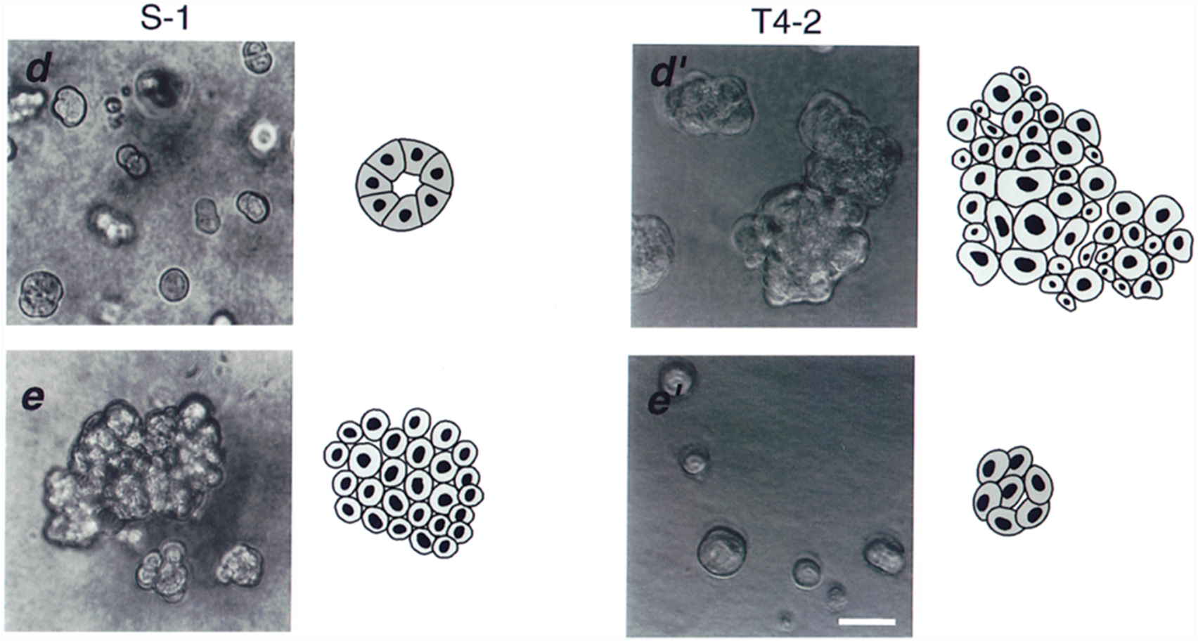 Jamming transitions in cancer - IOPscience