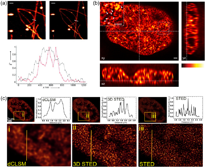 Application of STED imaging for chromatin studies - IOPscience