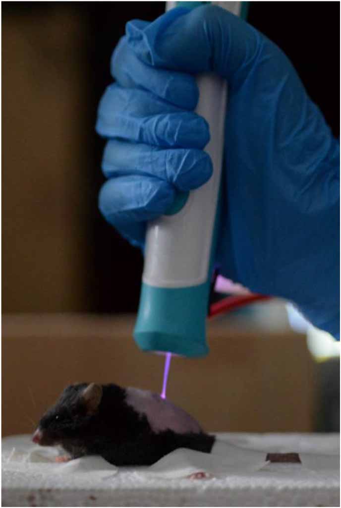 Low temperature plasma promotes the healing of chronic wounds in ...