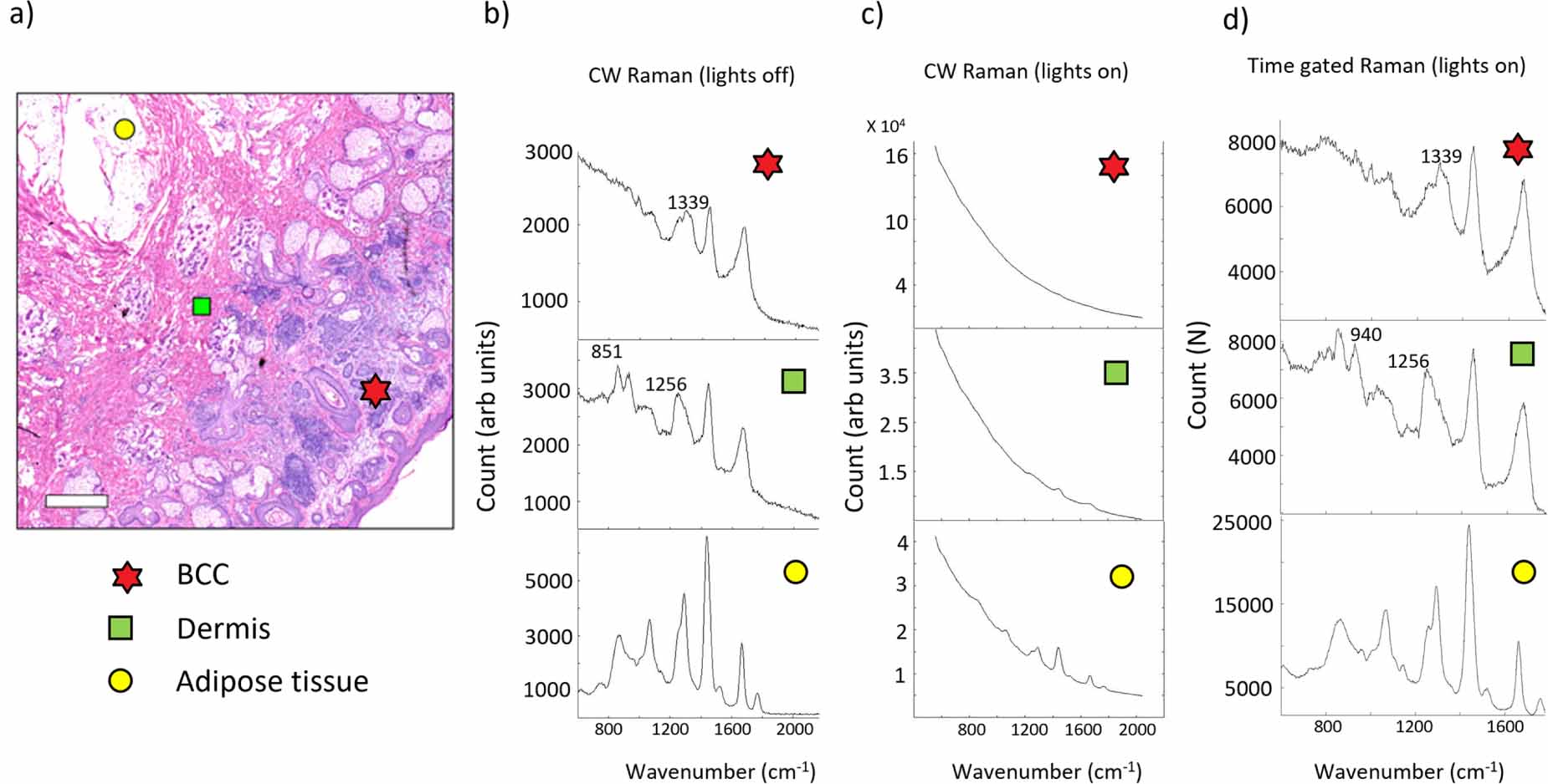 Time-gated Raman spectroscopy for biomedical application under ambient ...