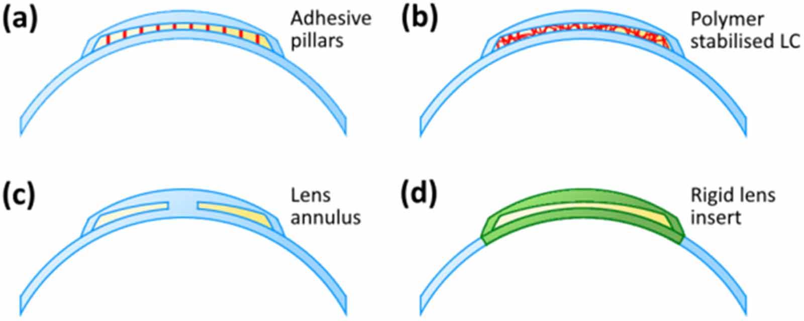 Infrared triggered smart contact lens for the treatment of presbyopia ...
