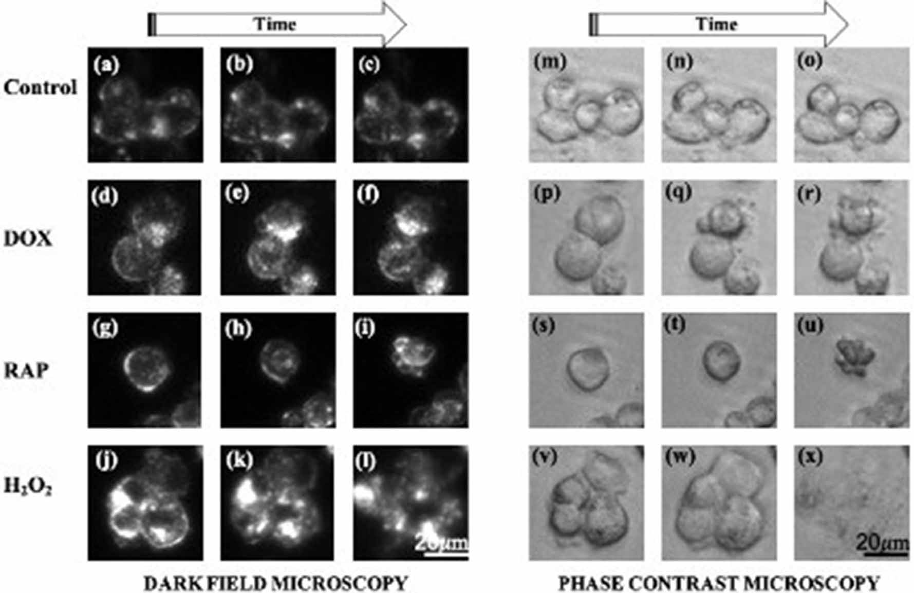 Label-free identification of cell death mechanism using scattering ...