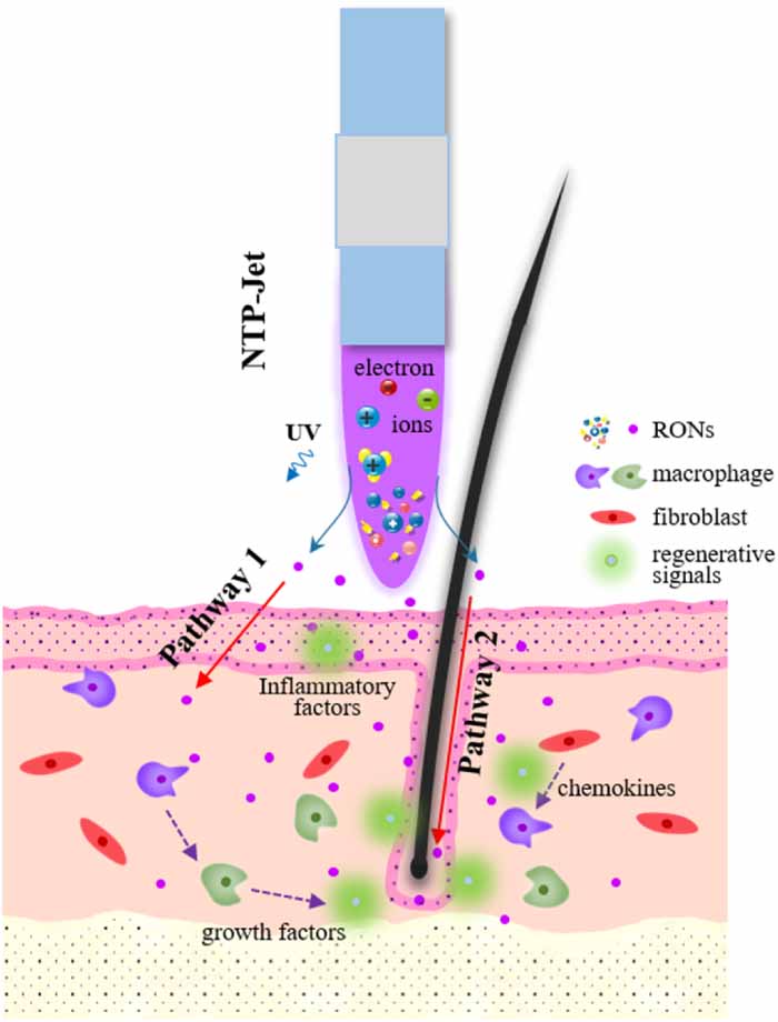 Activation of the hair follicle stem cells by low temperature pulsed ...