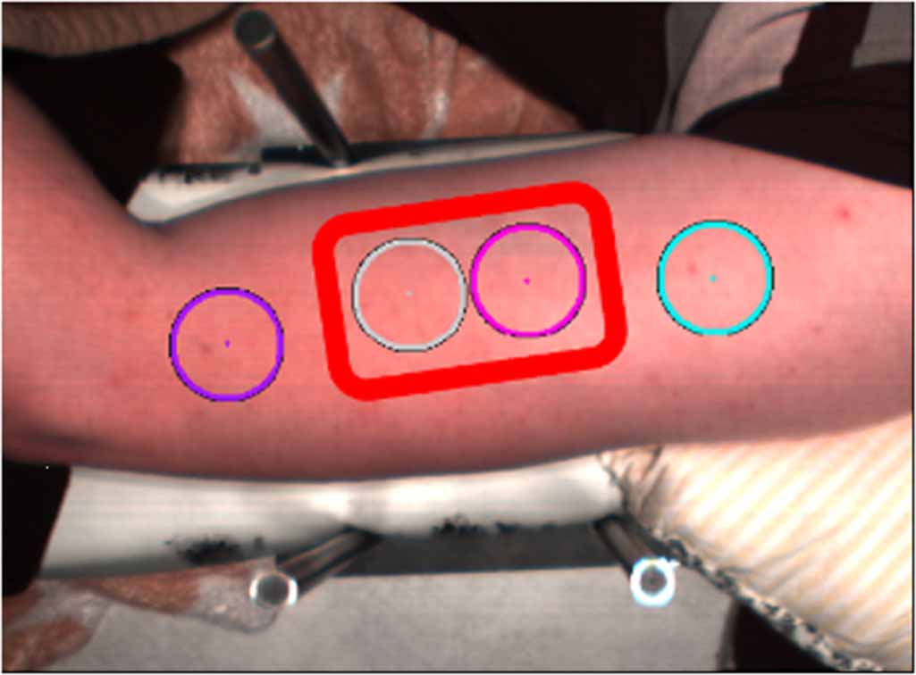 Which CAP components are relevant for enhancing dermal microcirculation ...