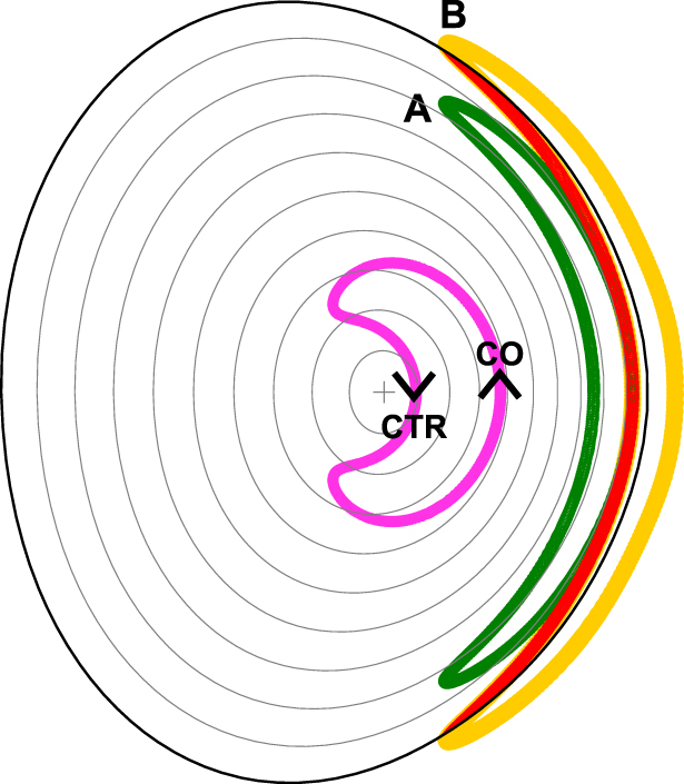 The formation of an radial edge electric field due to finite ion orbit ...
