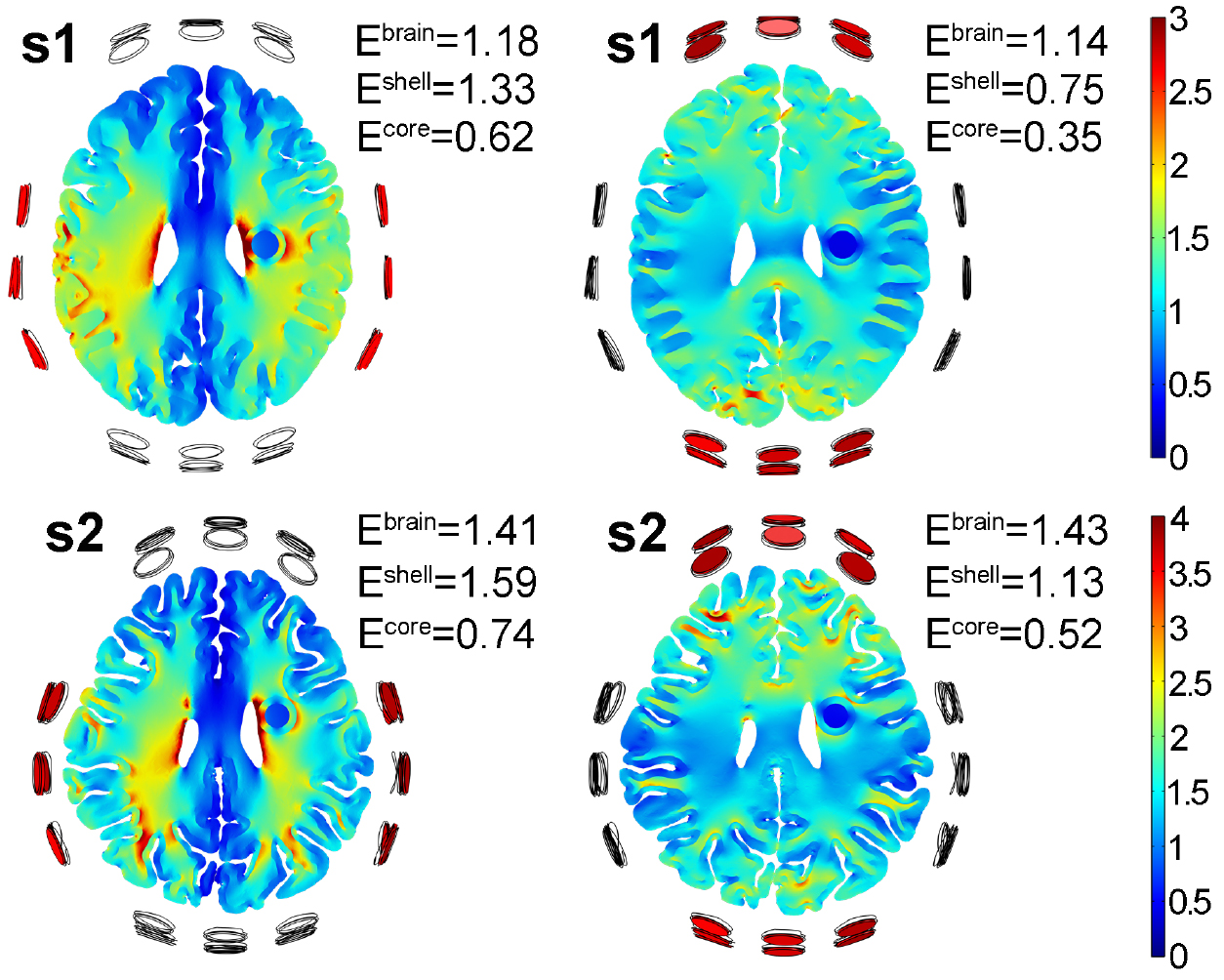 The electric field distribution in the brain during TTFields therapy ...