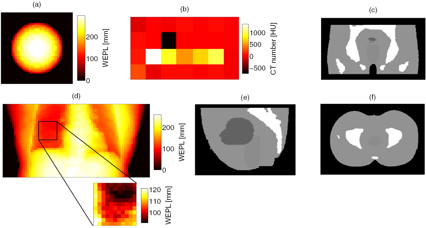 Patient-specific stopping power calibration for proton therapy planning ...