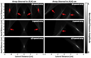 Image-guided ultrasound phased arrays are a disruptive technology for ...