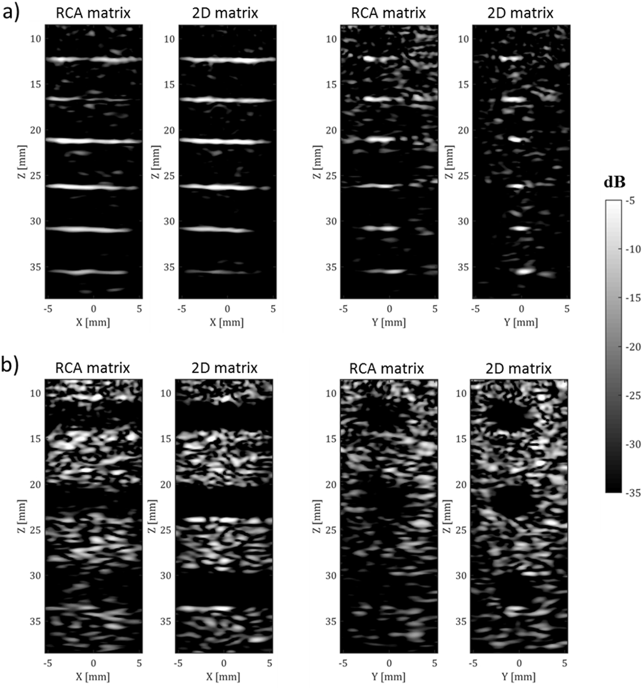 4D in vivo ultrafast ultrasound imaging using a row-column addressed ...