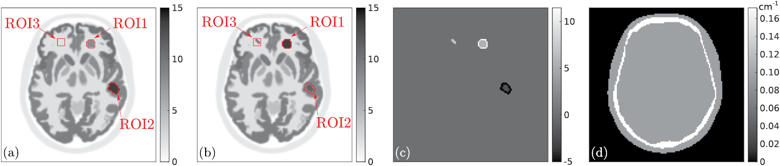 Simultaneous maximum a posteriori longitudinal PET image reconstruction ...