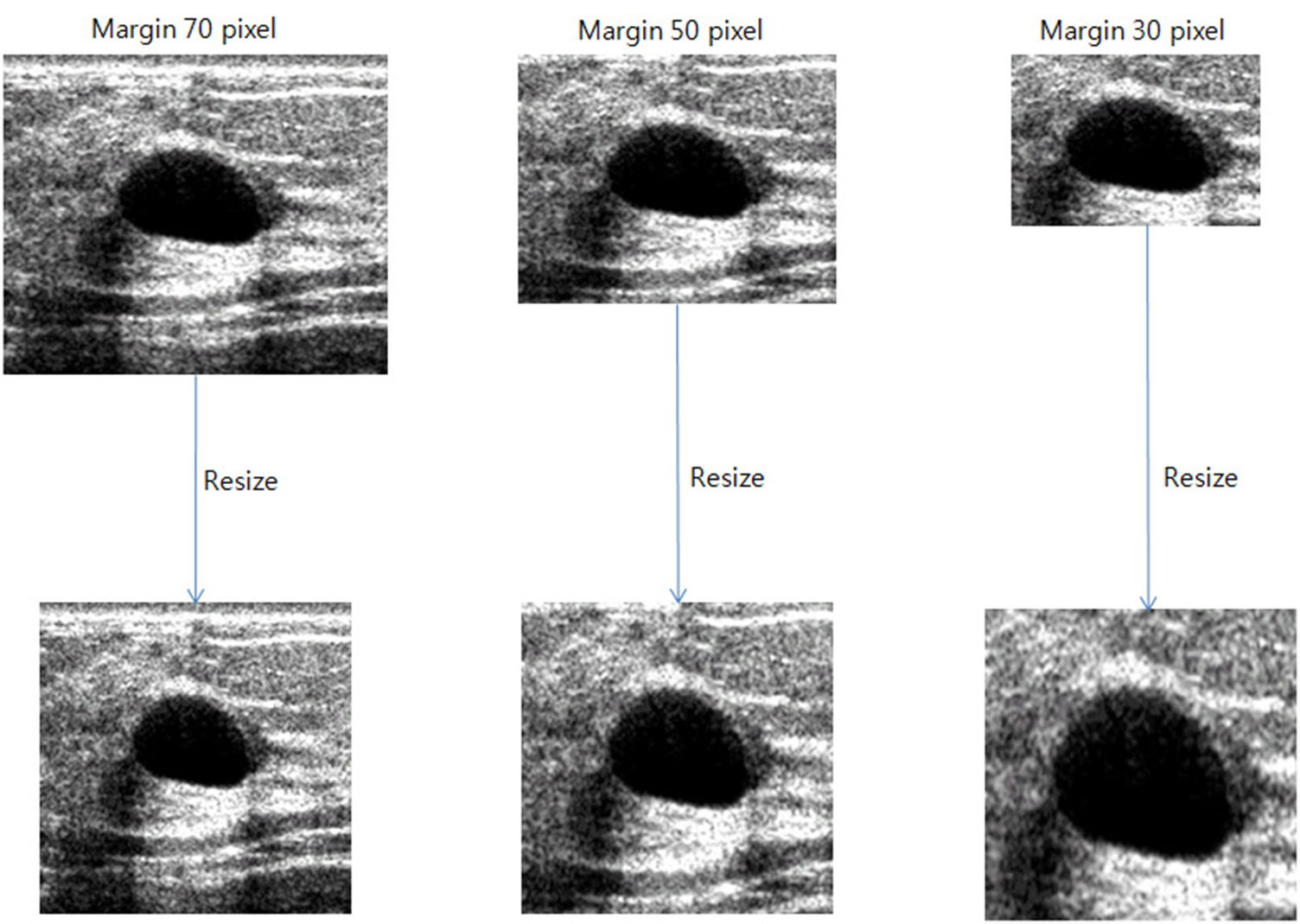 A deep learning framework for supporting the classification of breast ...