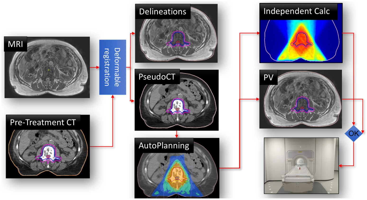 First patients treated with a 1.5 T MRI-Linac: clinical proof of ...