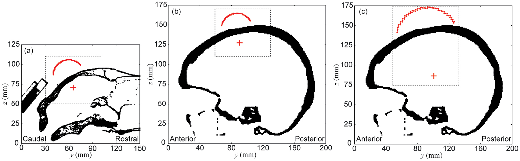 Multi-resolution simulation of focused ultrasound propagation through ...