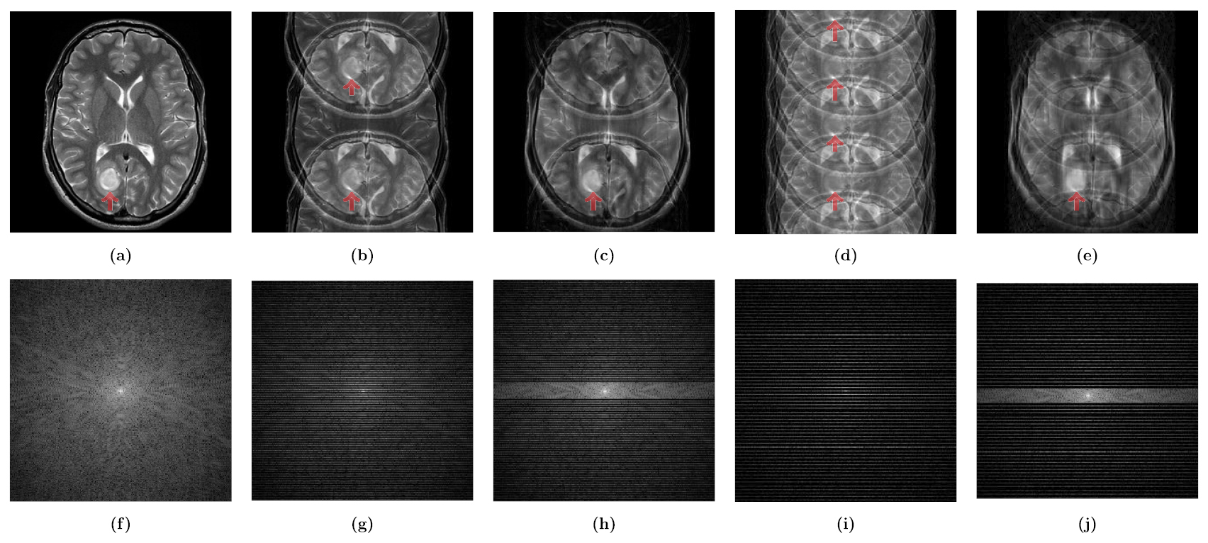Deep learning for undersampled MRI reconstruction - IOPscience
