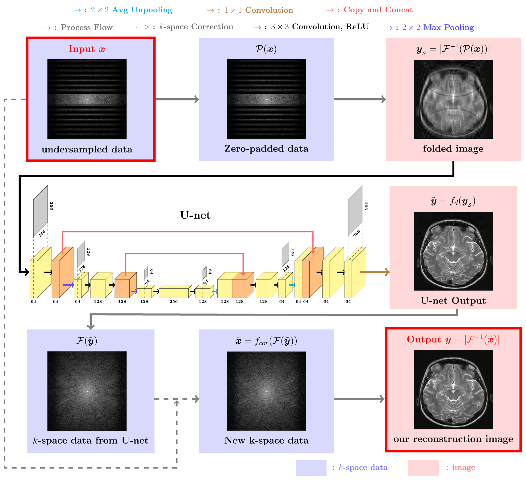 Deep learning for undersampled MRI reconstruction - IOPscience