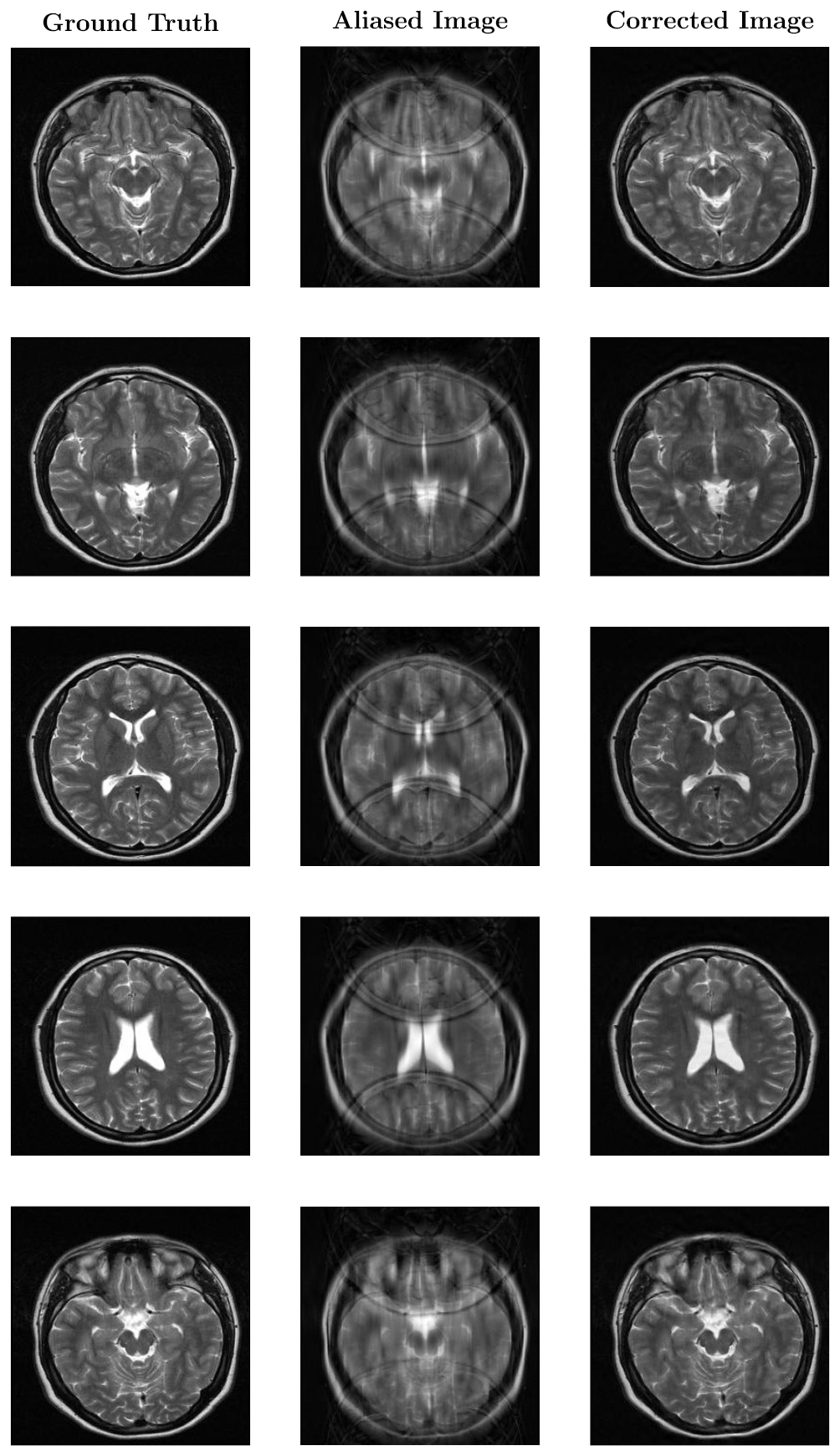 Deep learning for undersampled MRI reconstruction - IOPscience
