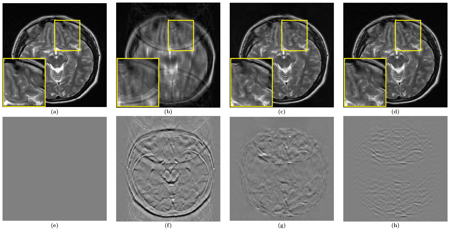 Deep learning for undersampled MRI reconstruction - IOPscience