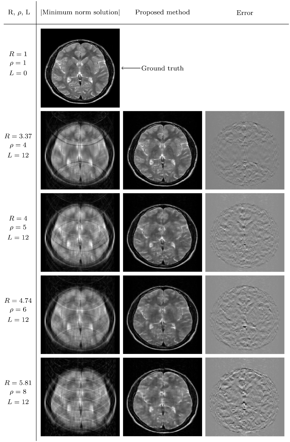 Deep learning for undersampled MRI reconstruction - IOPscience