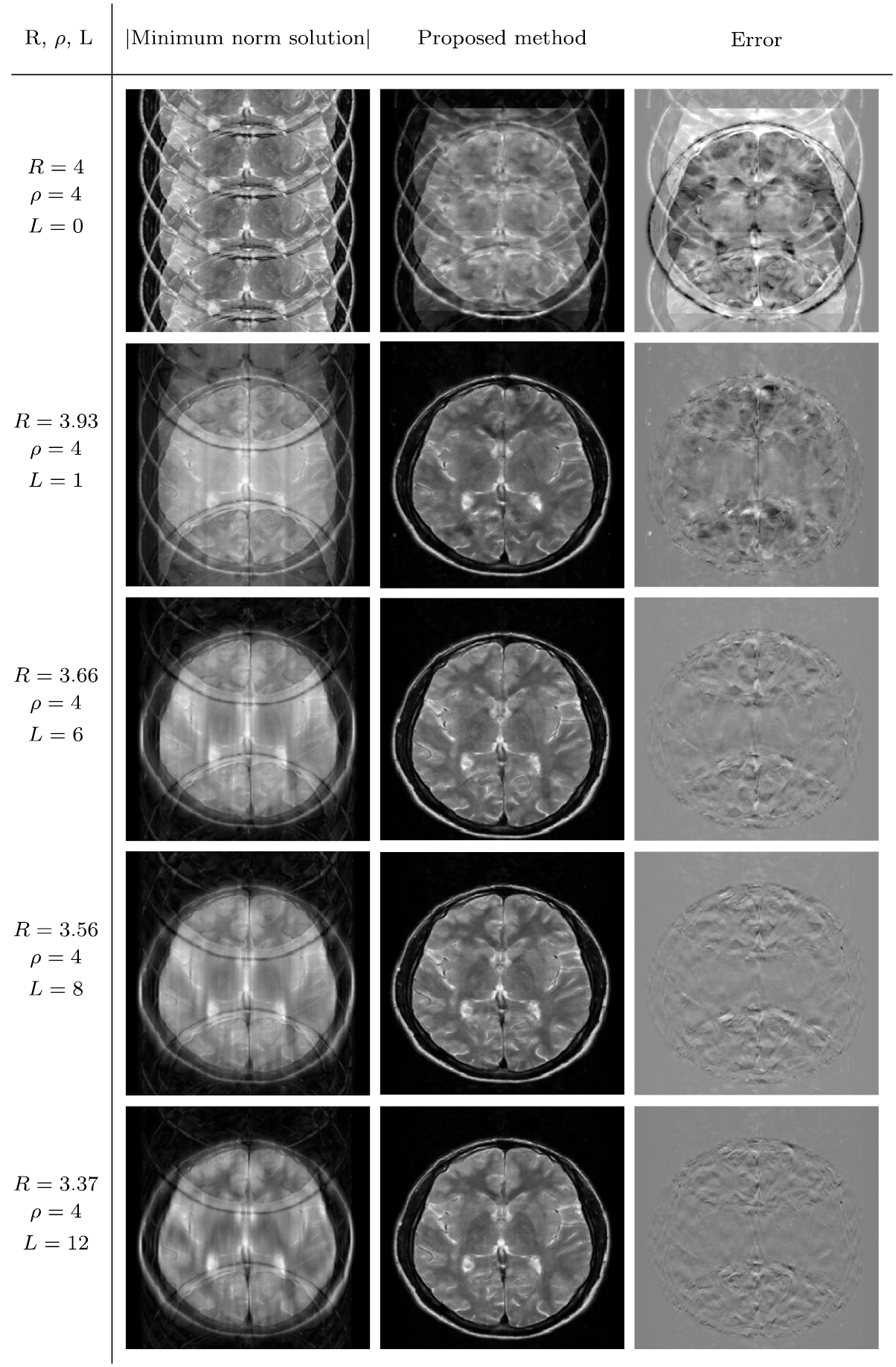 Deep learning for undersampled MRI reconstruction - IOPscience