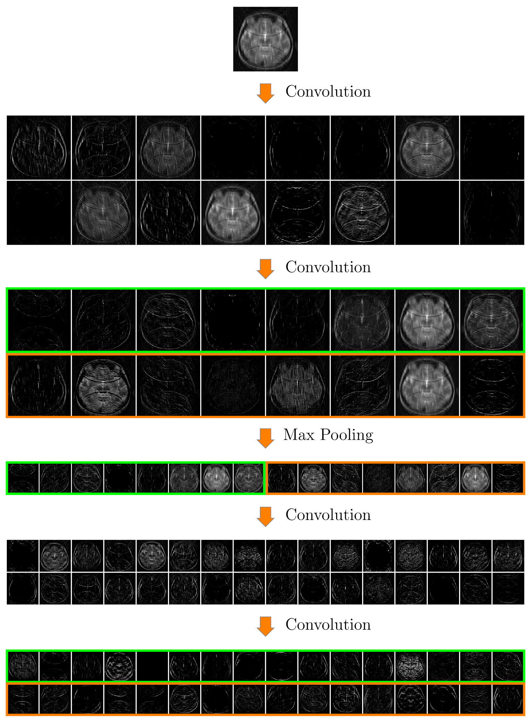 Deep learning for undersampled MRI reconstruction - IOPscience