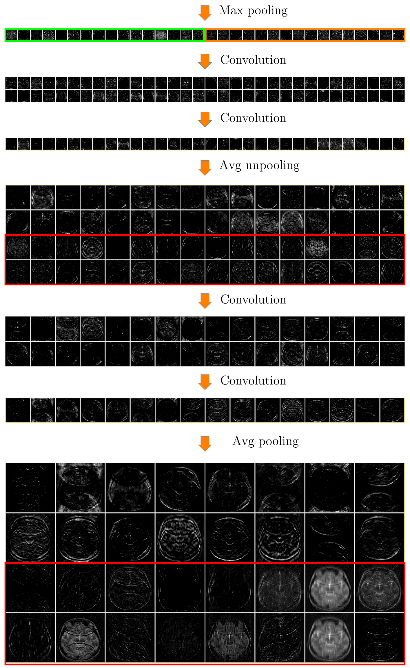 Deep learning for undersampled MRI reconstruction - IOPscience